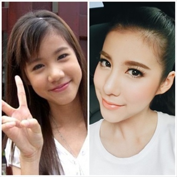 "เอสเธอร์" ศัลยกรรมมา หน้าเปลี่ยนไปเลย! - Popcornfor2.com